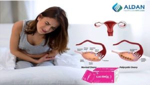 LACORIA: Best Medicine For Leucorrhea | Leukorrhea Treatment Tips