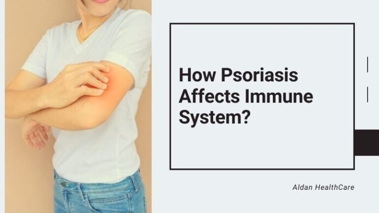 How Psoriasis Affects the Immune System | Aldan Healthcare